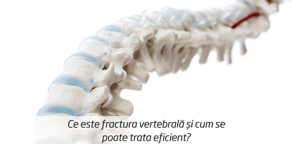 Ce este fractura vertebrală și cum se poate trata eficient?